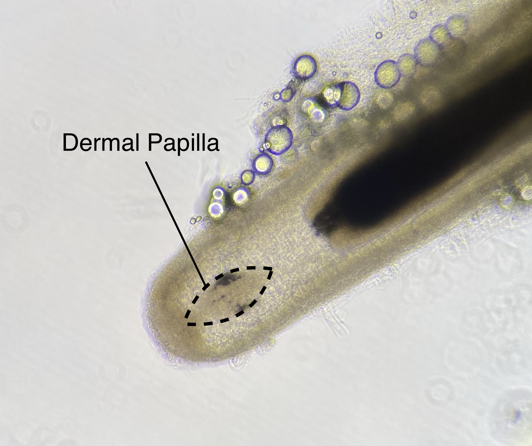 Hair Follicle Banking – Hairclone