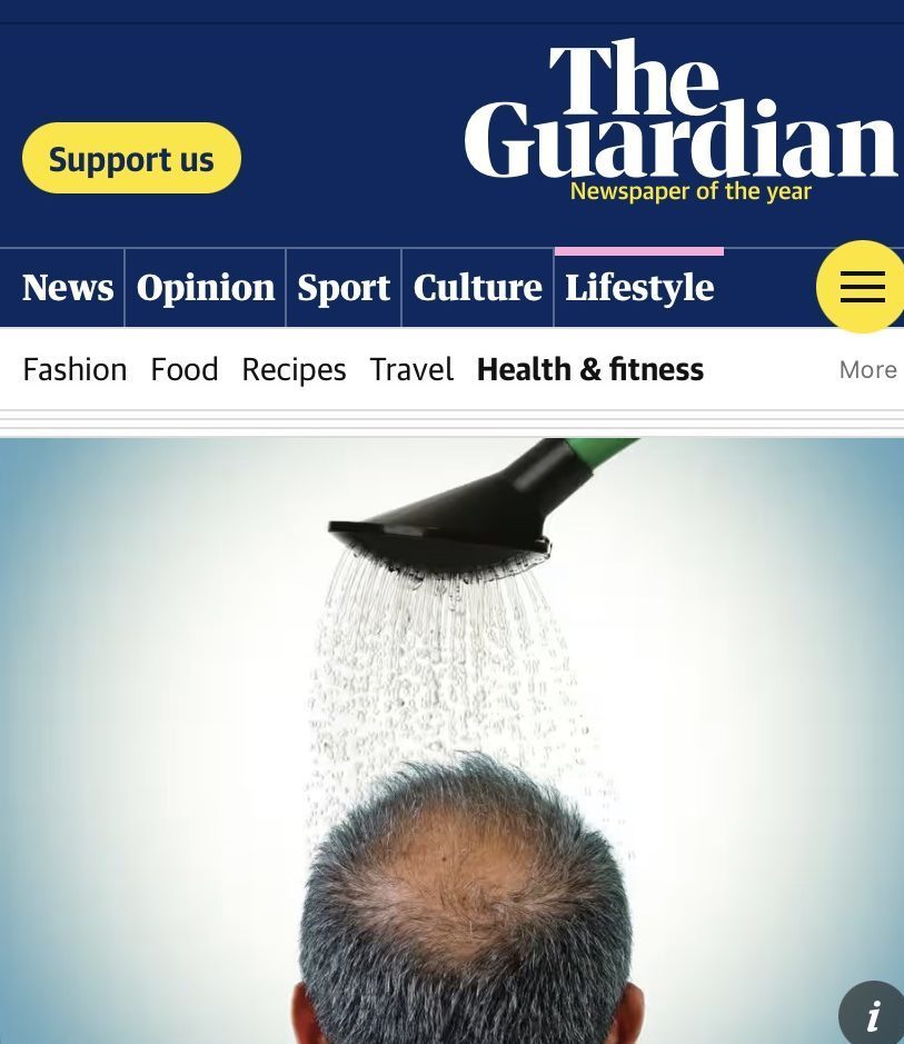 HairClone featured in article by The Guardian – Hairclone