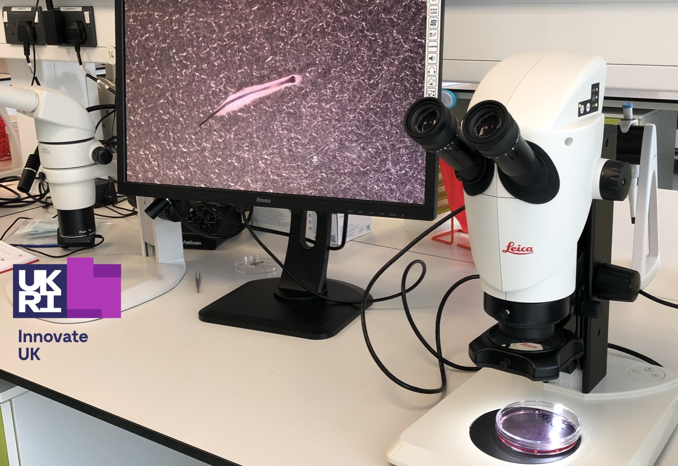 Hairclone – Making hair loss history